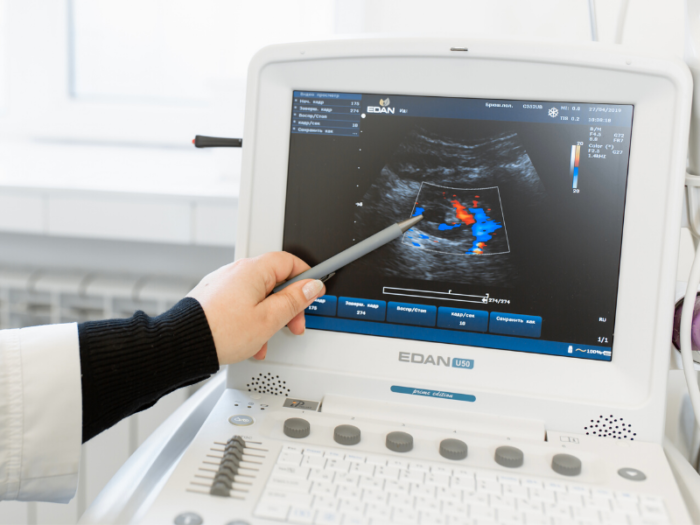 Premelab | Ecodoppler color